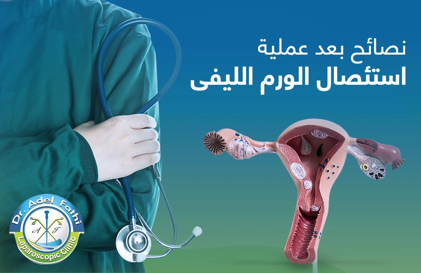 إليكِ أهم نصائح بعد عملية استئصال ورم ليفي | Dr.Adel Fathy